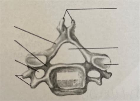 Solved What Bone Is This And How Do I Label It