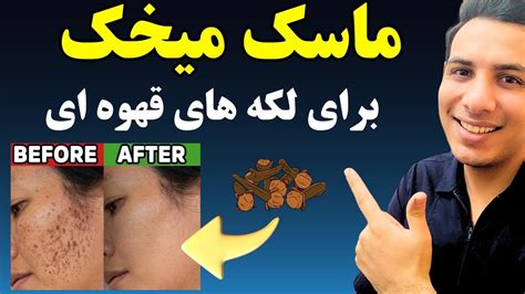 ماسک صورت با پودر میخک برای لکه های قهوه ای ، چین و چروک، خشکی و جای
