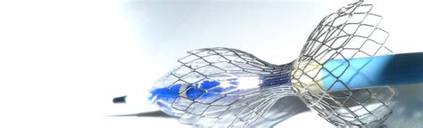 Neovasc Reducer System Receives First National Reimbursement In Europe