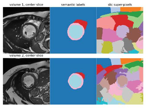 A Visual Example That Demonstrates The Shortcoming Of Existing Local Download Scientific