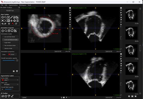 의료 영상 관련 프로그램 개발해드려요 크몽
