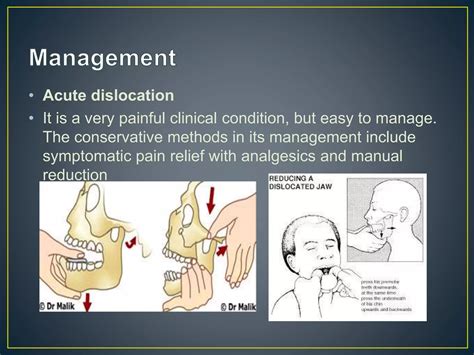 Temporomandibular Joint Dislocation Pptx