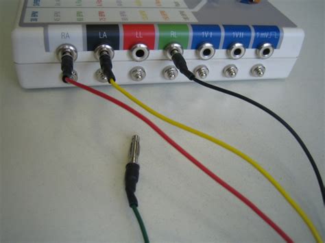 Noise In The Ecg Signal Data Converters Forum Data Converters Ti E2e Support Forums