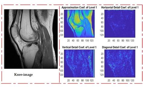 Wavelet Decomposition A Dwt Decomposition B Swt Decomposition