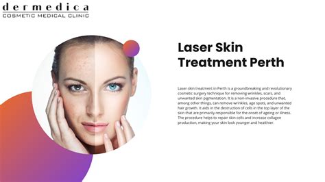 Ppt Laser Skin Treatment Perth Powerpoint Presentation Free Download