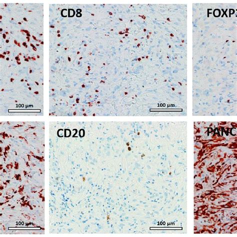 Representative Examples Of Hematoxylin Eosin Immunohistochemical