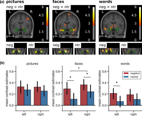 Amygdala Activation By Negative Versus Neutral Stimuli A Top Row