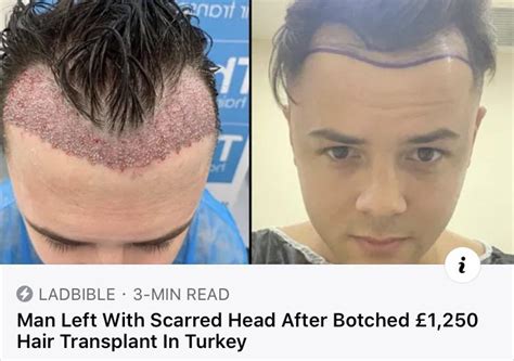 Oh No R Awfuleverything