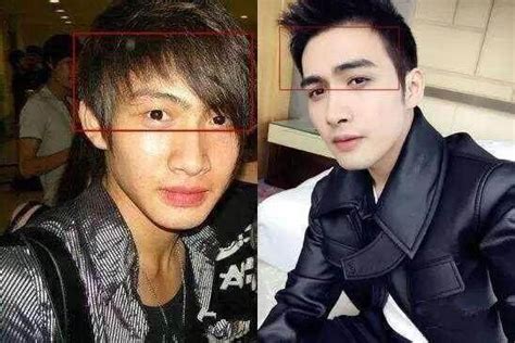 谁说只有女生爱美，男星也在悄悄整容