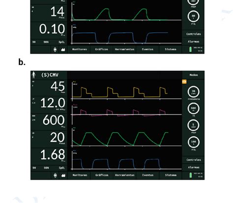 Curvas De Presi N Tiempo Flujo Tiempo Volumen Tiempo Y Pco Tiempo Download Scientific