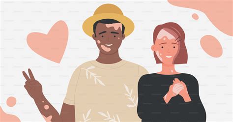 백반증 벡터 삽화를 가진 사람들 함께 서 있는 긍정적인 남자 여자 캐릭터의 만화 초상화 바디 포지티브 자기애 및 탈색병 세계 백반증의 날 개념 벡터