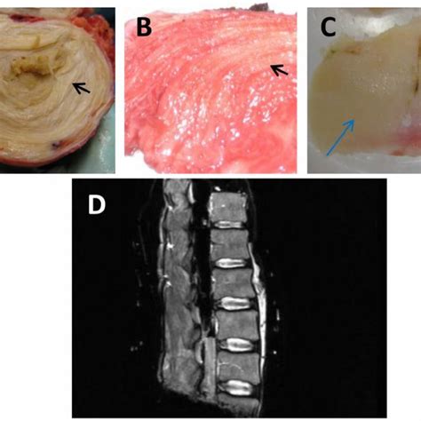 Yejia Zhang Assistant Professor Md Phd University Of Pennsylvania Pa Up Department