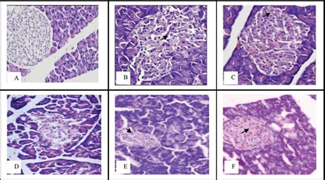 Histological Sections Of Rat Pancreas From Different Groups H And E