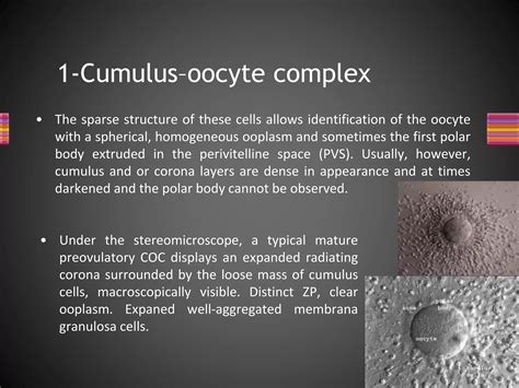 Oocyte Morphology Assessment Pptx