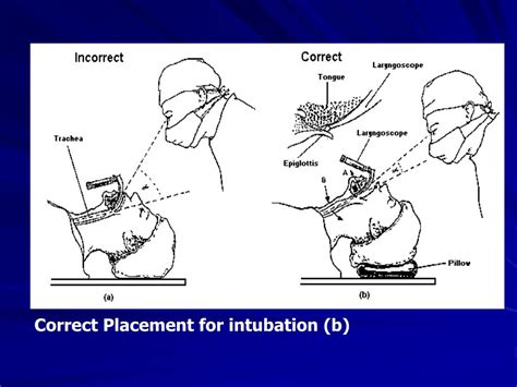 PPT The ABC Of RSI PowerPoint Presentation Free Download ID 6666739