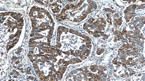 Ctp Synthase Rabbit Polyclonal Antibody
