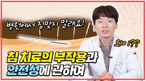 병원서 침맞지 말래요 침맞지 말라고 하는 이유 침치료의 부작용과 안전성에 관하여 Youtube