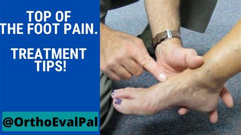 Foot Pain Joints At George Farrow Blog