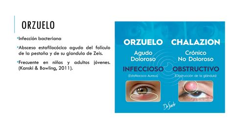Diferencias Entre Chalazion Orzuelo Y Pterigion Pptx