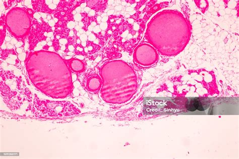 Trachea Thymus Parathyroid Gland And Tonsil Human Under The Microscope