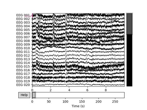 Transform Eeg Data Using Current Source Density Csd — Mne 0221 Documentation