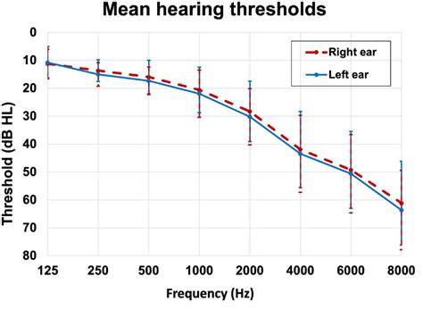 Mean Hearing Threshold Of The 26 Elderly Subjects With Arhl Download Scientific Diagram