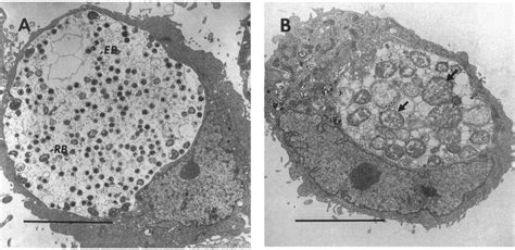 Electron Micrographs Of C Trachomatis Infected Cells A A Typical