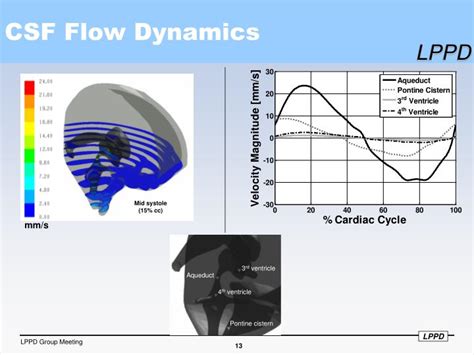 PPT Measurements And Computational Modeling Of Cerebrospinal Fluid Flow In Humans PowerPoint