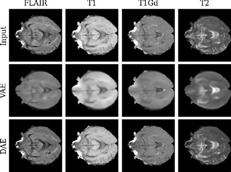 Figure 2 From Denoising Autoencoders For Unsupervised Anomaly Detection
