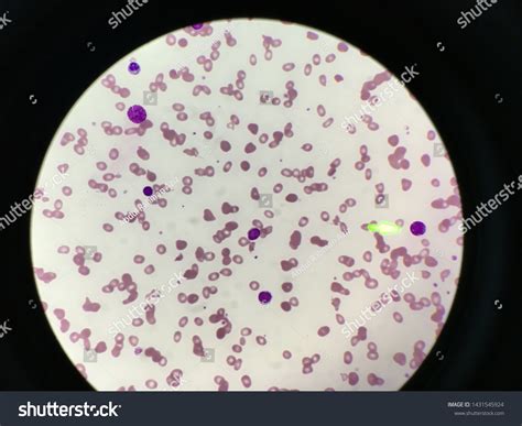 Basophil Cells Under View Microscope Foto De Stock 1431545924