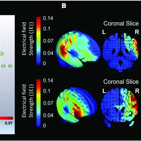 Current Flow Modeling During 1 Ma High Definition Transcranial Direct