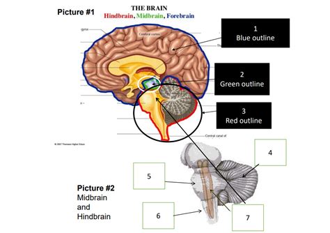 Solved THE BRAIN Picture Hindbrain Midbrain Chegg Com
