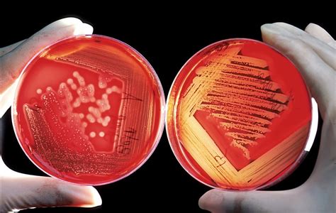 streptococcus pyogenes the clot buster the microbial menagerie