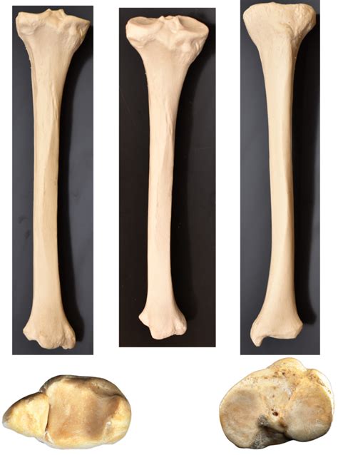 Tibia Diagram Quizlet