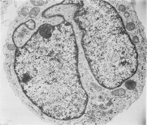 Ultrastructure Of A Binuclear Cell Showing A Thread Of Nuclear Download Scientific Diagram