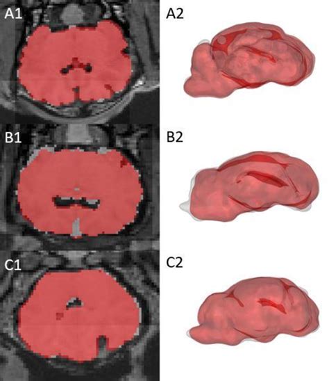 Figure 2 From Atlas Free Automatic Segmentation Of Sheep Brain Mri Semantic Scholar