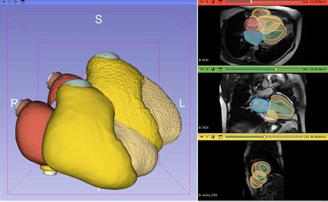 Copy Headers Metadata Between Segmentations Of Different Resolutions Algorithms Itk