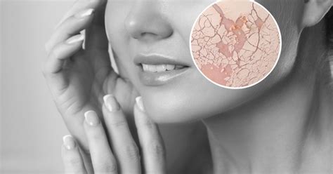 낙엽처럼 푸석푸석한 가을 피부 얼굴 부위별 탄력 높이는 꿀팁은