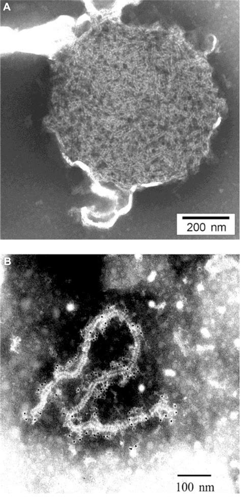 Structure Of The Nipah Virus Virion Core Notes A Nucleocapsid Core