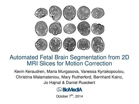 Pdf Automated Fetal Brain Segmentation From 2d Mri Slices For Motion Correction Dokumentips