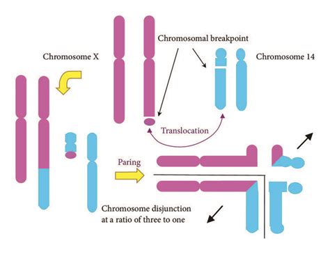 Pachytene Scheme Of Fetal Chromosomal Abnormality Download