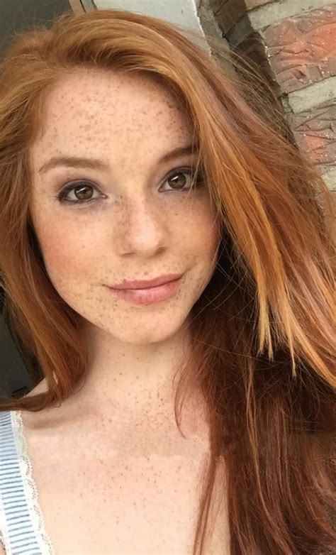 Pin On Redheads And Freckles