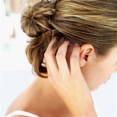 3 Easy Ways To Get Rid Of Dry Flaky Scalp Beauty Ramp Beauty Fashion Guide By Dr Prem