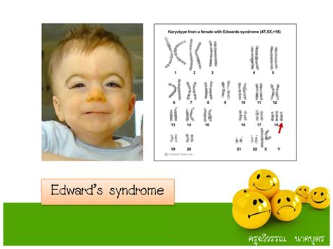 มิวเทชัน Mutation Pdf
