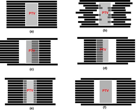 Three Types Of Mlc Position Errors Introduced To Each Sbrt Plans A