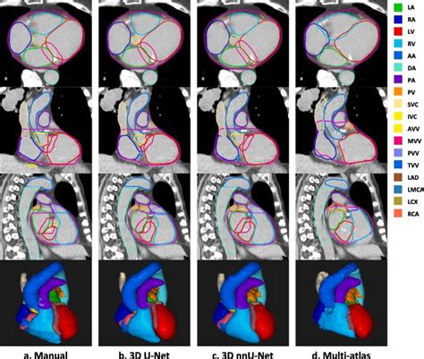Deep Learning Based Automatic Segmentation Of Cardiac Substructures For