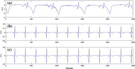 extraction of fecg signal from actual dataset a abdominal signal of