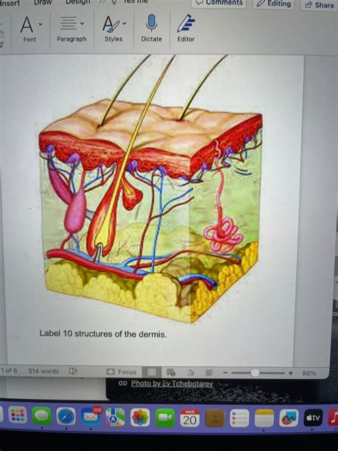 Answered Label 10 Structures Of The Dermis Bartleby
