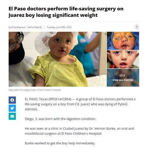 En Las Noticias Los Mejores Cirujanos Orales En El Paso Tx Noticias