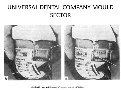 Anterior Teeth Selection Pptx Dental Health Diseases And Conditions